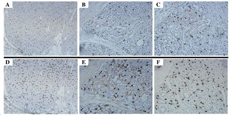 Immunostaining For E2 And Tryptase In Ih Large Numbers Of E2 A Ihc Download Scientific