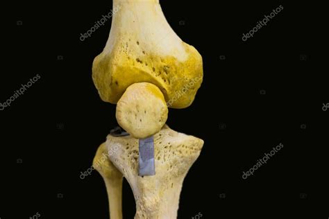 Antero Vista Posterior De Los Huesos Articulados De La Rótula Del
