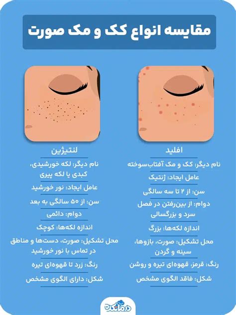 کک و مک صورت چیست؟ انواع، پیشگیری، روش درماندرمان خانگی