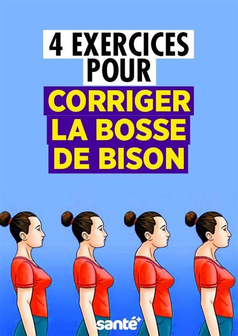 Exercices Pour Corriger La Bosse De Bison