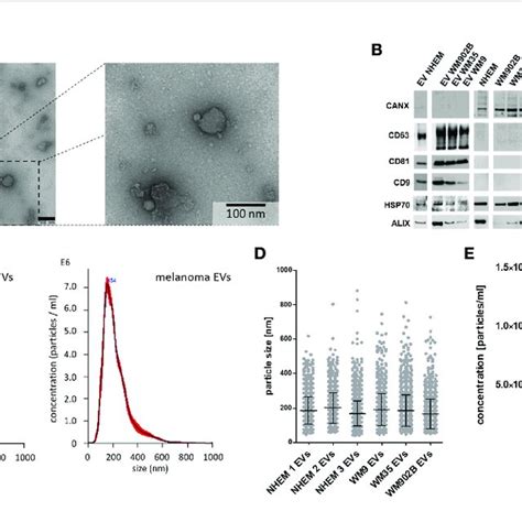 Isolation And Characterization Of Extracellular Vesicles A Download Scientific Diagram