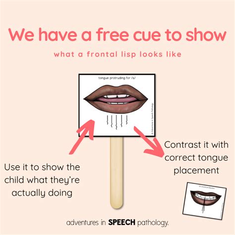 Frontal Lisp Effective Speech Therapy Tips