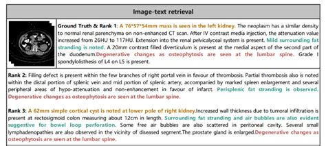 M3d 基于多模态大模型的新型3d医学影像分析框架，将3d医学图像分析从“看图片“提升到“理解空间“的层次，支持检索、报告生成、问答、定位和