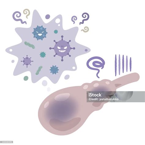 Illustration Of A Gallbladder Infected With A Virus Stock Illustration