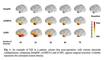 Eeg Source Imaging Using A Biophysically Constrained Deep Neural Network Robust Performance For