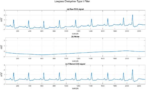Elimination Of Ecg Signal Noise With Chebyshev Type Ii Filter 105th