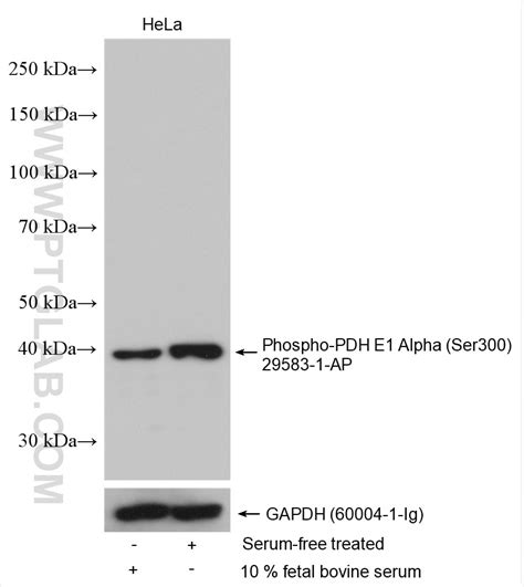 Phospho Pdh E1 Alpha Ser300 Antibody 29583 1 Ap Proteintech