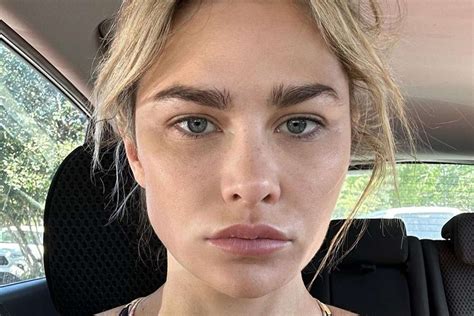Bachelor Star Megan Marx Diagnosed With Rare Neurological Disorder