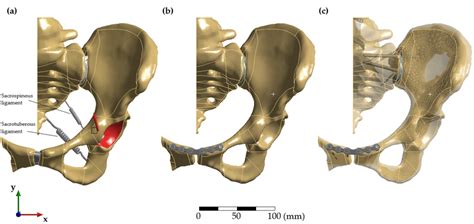Finite Element Models Including Bones Cartilage And Ligaments A Download Scientific