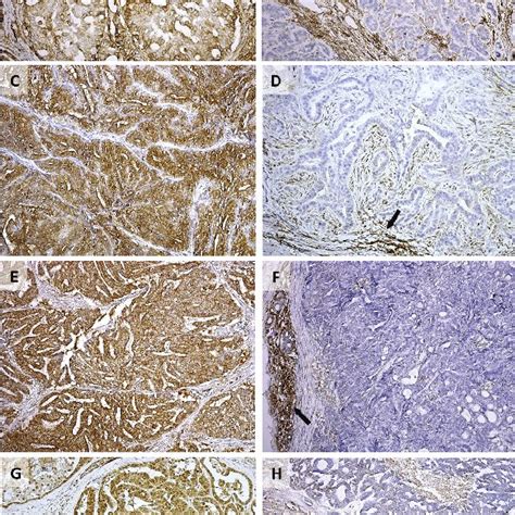 Immunohistochemical Staining Patterns Of Formalin Fixed Download Scientific Diagram