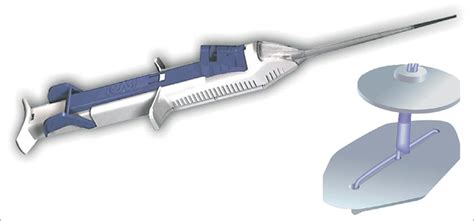 Randomised Comparison Of Manual Compression And Femoseal™ Vascular Closure Device For Closure