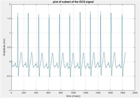 biomedical signal and image processing projects using matlab and
