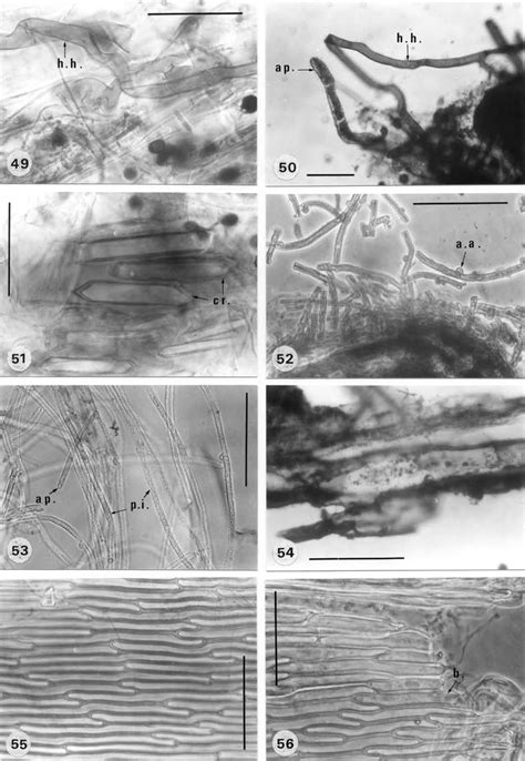 Young Pine Branch Detail Showing Dead Hyaline Hyphae Of Haplographium