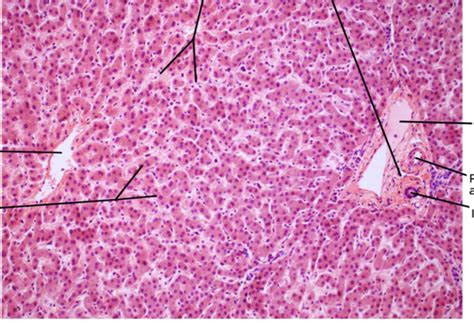 Liver Diagram Quizlet