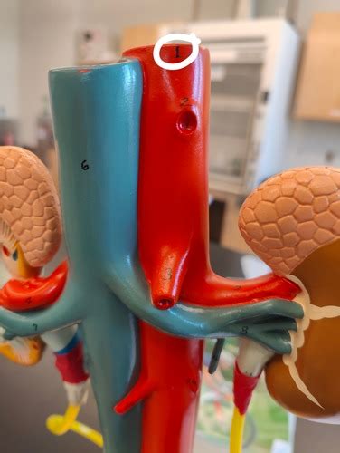 Anatomy Practical 2 Urinary System Flashcards Quizlet