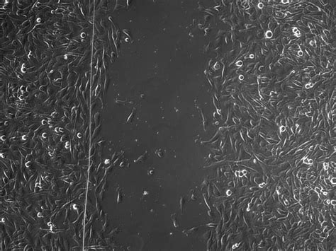 Remove A Physical Scratch Artifact From Imagej Stack Image Analysis Imagesc Forum