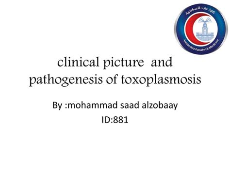 Pathogenisis And Clinical Picture Of Toxoplasmosis Ppt