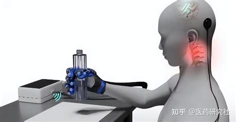 首款侵入式器械获批！历经半个世纪，脑机接口终入医疗现实 知乎