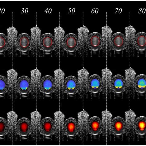 The Nn And Doppler Oct Measurements With Varying Flow Rate The First Download Scientific