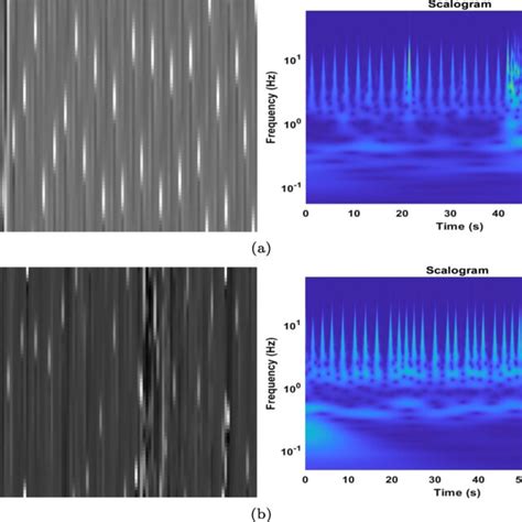 1d Ecg Reshaped To A 2d Image And Ecg Scalogram A Normal Ecg B Download Scientific Diagram