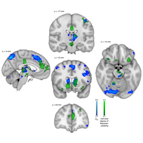 Models Of The Neurobiology Of Ocd A The Traditional Cstc Model