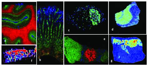 Maldi Msi Molecular Pictures Obtained By Maldi Tandem Mass Spectrometry