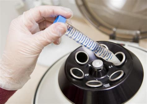 What Is Tissue Homogenization With Pictures