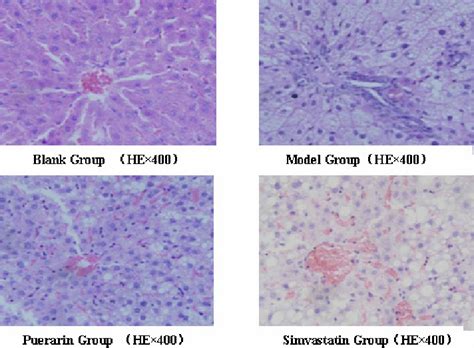 Pathological Slides Of Liver With He Staining After Treatment At 8th
