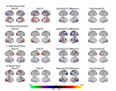Seed Based Fc Findings Seed Based Functional Connectivity P Download Scientific Diagram