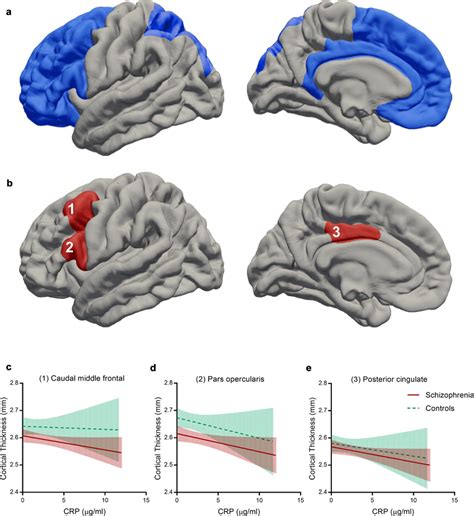 A Lateral Left And Medial Right Views Of The 13 Prefrontal And Download Scientific Diagram