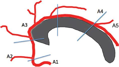 What I Learned Today Anterior Cerebral Artery