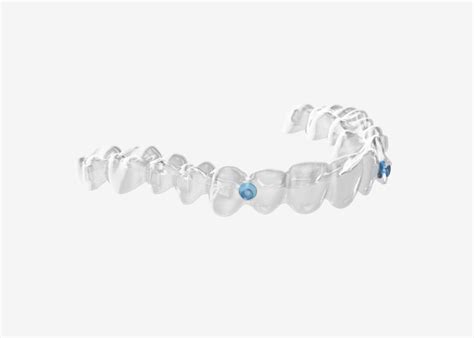 Orthodontie Invisible Par Aligneur Dentaire Angel Aligner