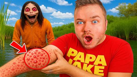 The Creepy Stranger Bit Me… Whats Happening To My Body Youtube