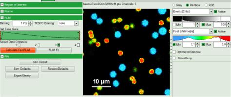 Howtolifetime Fittingusingtherapidreconvolutionalgorithm Time