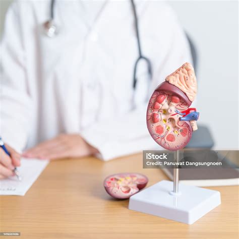 신장 부신 해부학 모델을 가진 의사 비뇨기 계통 및 결석 암 세계 신장의 날 만성 신장 비뇨기과 신장염 신장 이식 및 건강 개념 콩팥위샘에 대한 스톡 사진 및 기타 이미지