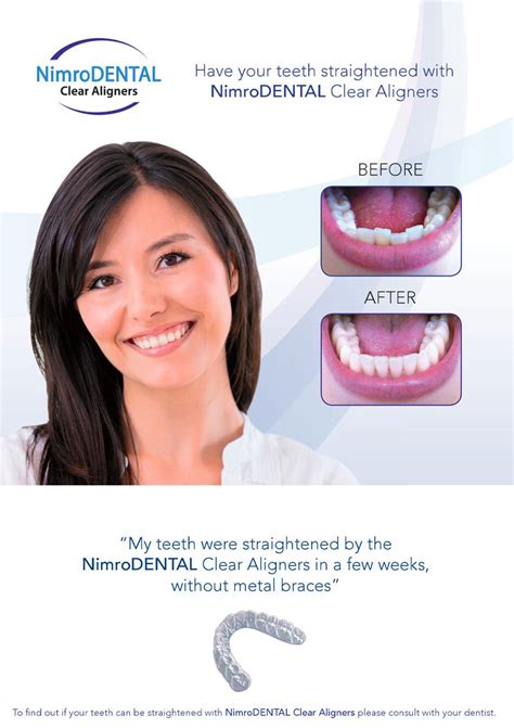 NimroDENTAL Clear Aligner Brochures X 50