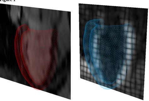 Figure 1 From Finite Element Digital Image Correlation For Cardiac