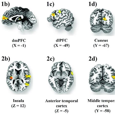 Sex Is Associated With The Ifc Of The Dmn Default Mode Network The Download Scientific