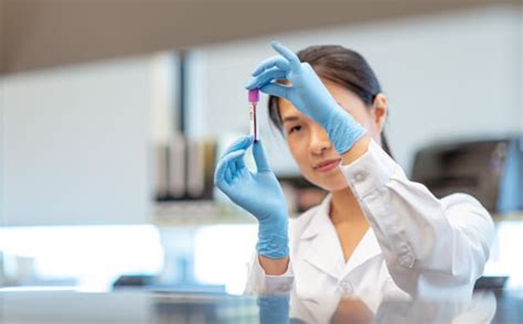 Creating A Universal Standard For Lab Test Names