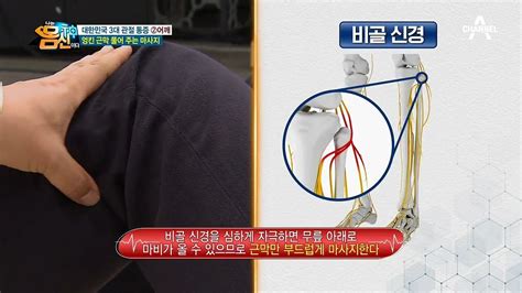 어깨 통증이 심하던 이창훈 근막 마사지를 받고 난 후 나타난 놀라운 변화 나는 몸신이다 253회 YouTube
