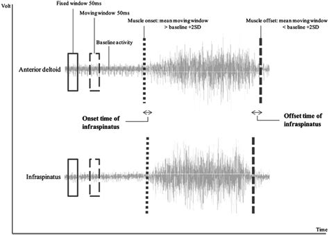 Visual Representation Of The Calculation Of Muscle Onset And Offset In
