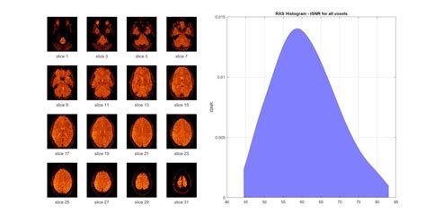 Fmri Noise Fmri Noise