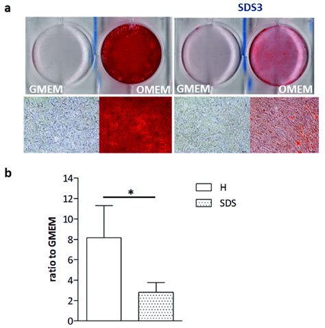 Mineralization Of Sds Obs And H Obs A Representative Image Of Download Scientific Diagram