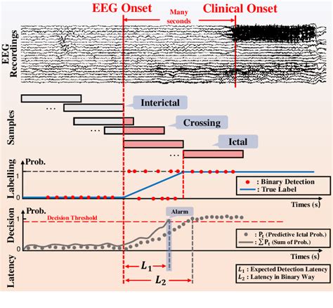 Figure 2 From Deep Learning For Short Latency Epileptic Seizure