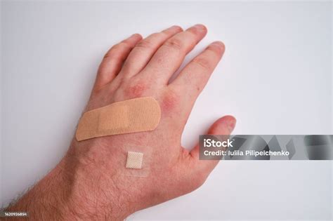 의료용 접착 석고를 클로즈업한 남성 손 손상된 피부에 접착 석고 상처와 상처에 대한 응급 처치 1위에 대한 스톡 사진 및 기타 이미지 Istock