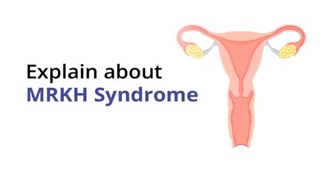 What Is Mrkh Syndrome Causes Symptoms And Treatment