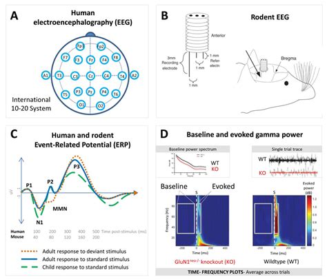Schematic Representation Of Human And Rodent Eeg Electrode Placement
