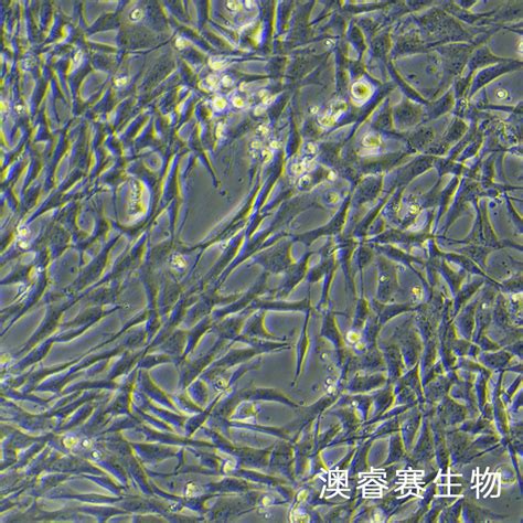人骨髓间充质干细胞 人原代细胞 原代细胞 澳睿赛生物技术（上海）有限公司 专业细胞生物学供应商
