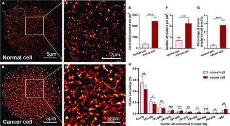 The Distribution Of Cdcp1 On Primary Non Small Lung Cancer Cells And