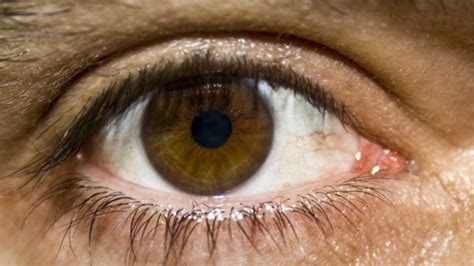 Bionic Glasses Help People ‘see